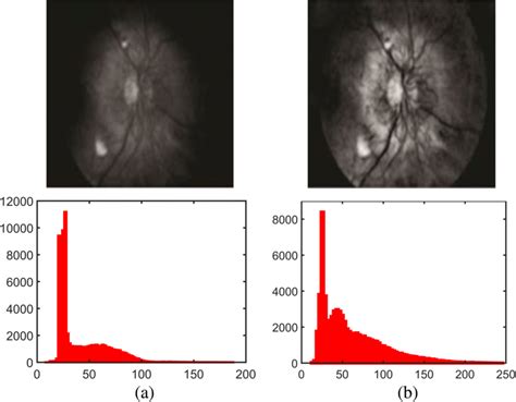 Results Of Normalization A Median Filter B Adaptive Histogram