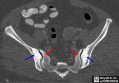 Diffuse Soft Tissue Swelling Mapasgmaes