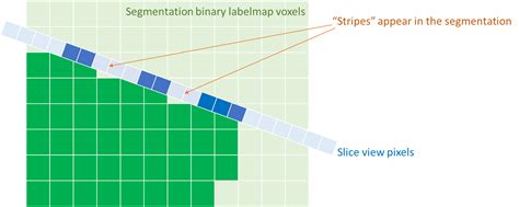 Overview 3d Slicer Segmentation Recipes