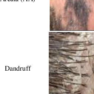 Sample Images Of Scalp Conditions Download Scientific Diagram