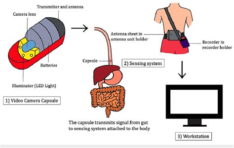 Video Capsule Endoscopy System Led Light Emitting Diodes Image