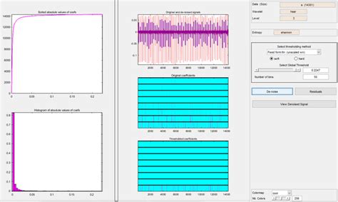 Ecg Signal Denoising Through Wavelet Analyzer Toolbox Download