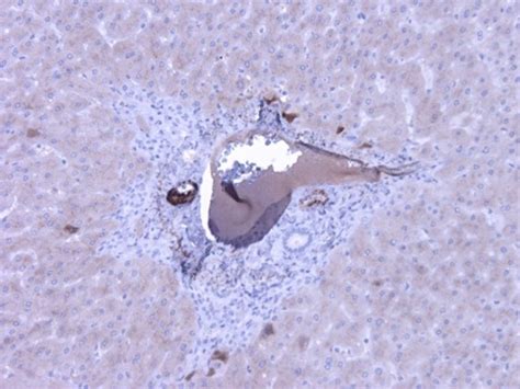 Anti Complement Component C9 Human Bioporto
