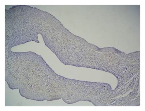 Observed αvβ5 Integrin Immunoreactivity Starred In The Extracellular