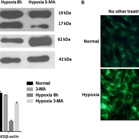 Autophagy Was Elevated In Hypoxic 661w Cells A Under Normoxic