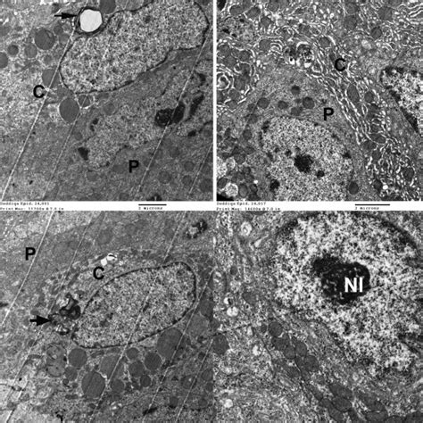 An Electromicrograph Of Caput Epididymis Tubules Group 3 24 H