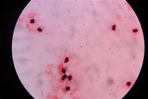 Bakteri Streptococcus Suis Ditularkan Lewat Ini