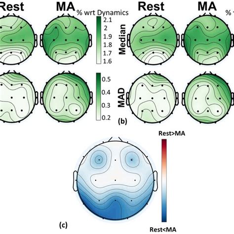 Topographical Representation Of Eeg Noise Distribution During The