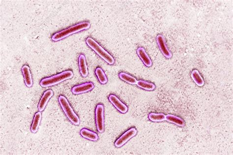 Pseudomonas Aeruginosa Bacteria Light Micrograph Stock Image C061 0026 Science Photo Library