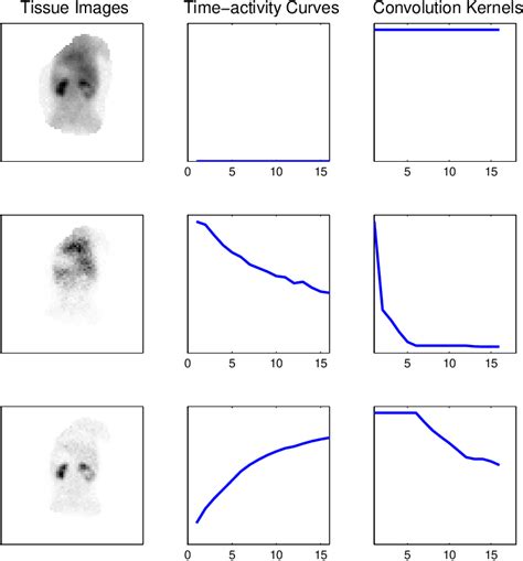 Figure 6 From Convolution Model Of Time Activity Curves In Blind Source