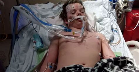 Benadryl Challenge El Reto Viral De Tiktok Que Est Matando A Los Adolescentes En Estados