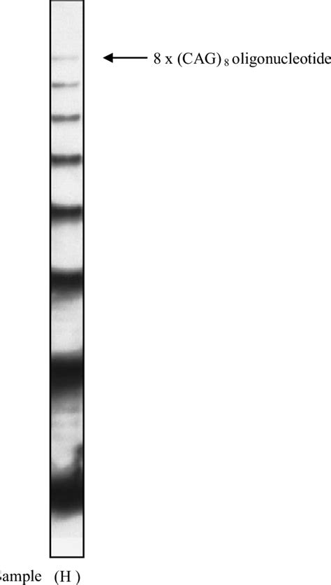 Figure 1 From Detection Of Cag Repeats In Pre Eclampsiaeclampsia Using The Repeat Expansion