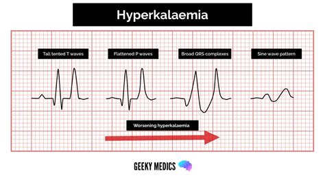 Managing Electrolyte Disturbances Fy1 Geeky Medics