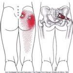 Piriformis Trigger Points How To Find And Self Treat
