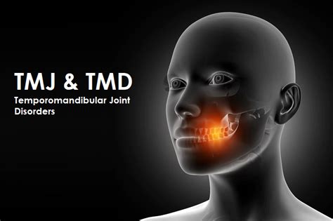 Tmj Disorders Causes Symptoms Treatments The Run Time