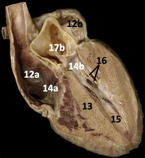 Lab 2 Diagram Diagram Quizlet