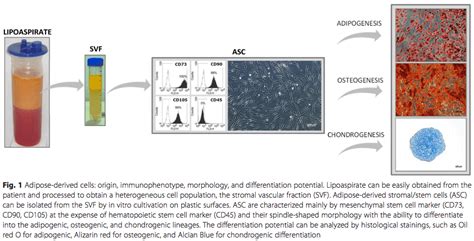 Ultrasonic Stem Cell Isolation