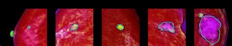 detection and segmentation examples using pseudo color images and mask