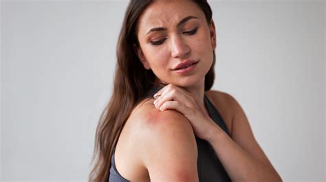 Skin Rashes 5 Types Causes And Effective Treatments Health News