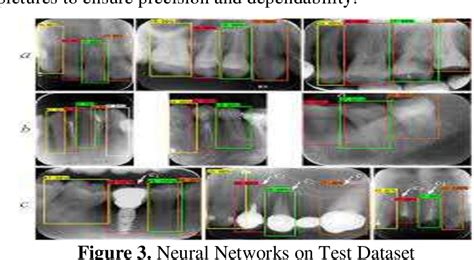 Figure 1 From Deep Recurrent Neural Network Based Assessment Of Human
