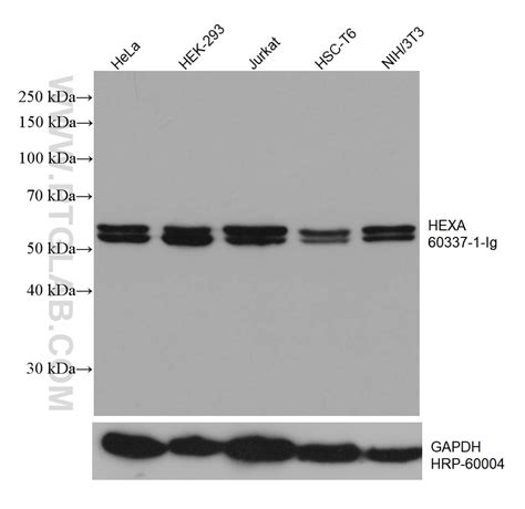 Hexa Antibody 60337 1 Pbs Proteintech