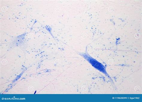 Giant Multipolar Neuron Stock Image Image Of Giant 119628399