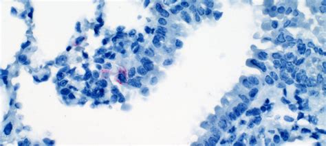 Scientists Identify Interferon Gamma As Potential Sars Cov 2 Antiviral