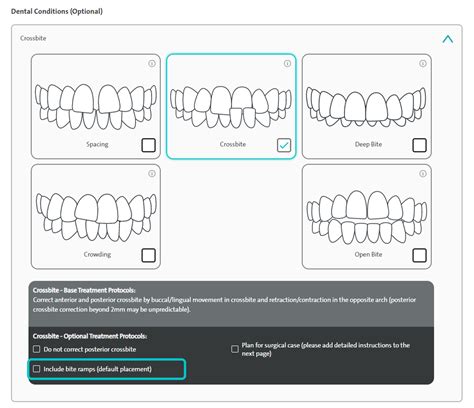 Bite Ramps Aligners Shop Wholesale Th