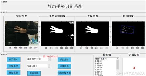 matlab手势识别技术实现 matlab实现手势识别 csdn博客