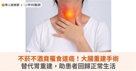 不菸不酒竟罹食道癌！大腸重建手術替代胃重建，助患者回歸正常生活 華人健康網 專業即時優質的健康新聞及資訊分享平台業即時優質的健康新聞及