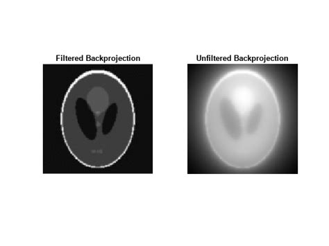 Inverse Radon Transform Matlab Iradon Mathworks Australia