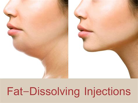 Fat Dissolving Injections Dissolves Cheek Fat Med Art