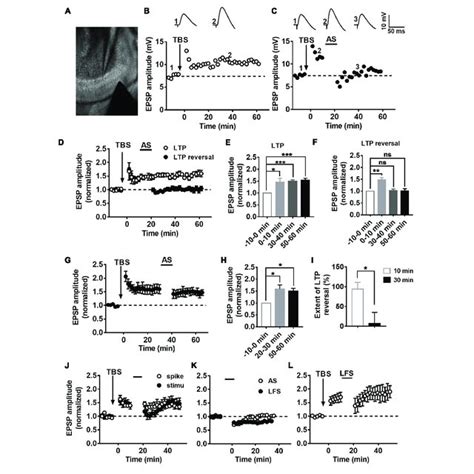 LTP And LTP Reversal Vary With The Developmental Stage Of The Download Scientific Diagram