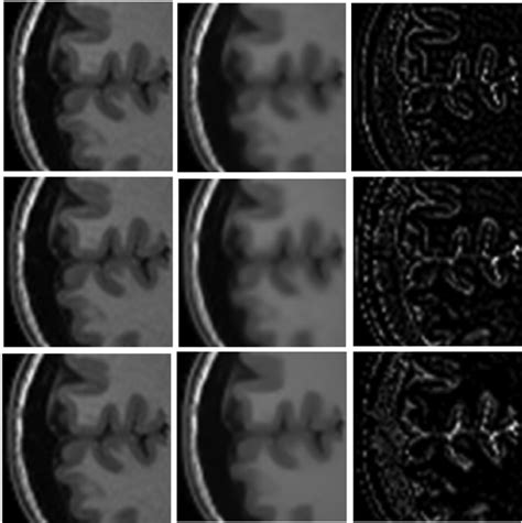 Qualitative Detail Comparisons Of Denoising Results Obtained With