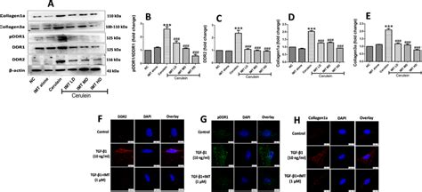 Inhibition Of Ddr1 And Ddr2 Expression Prevents Progression Of Download Scientific Diagram