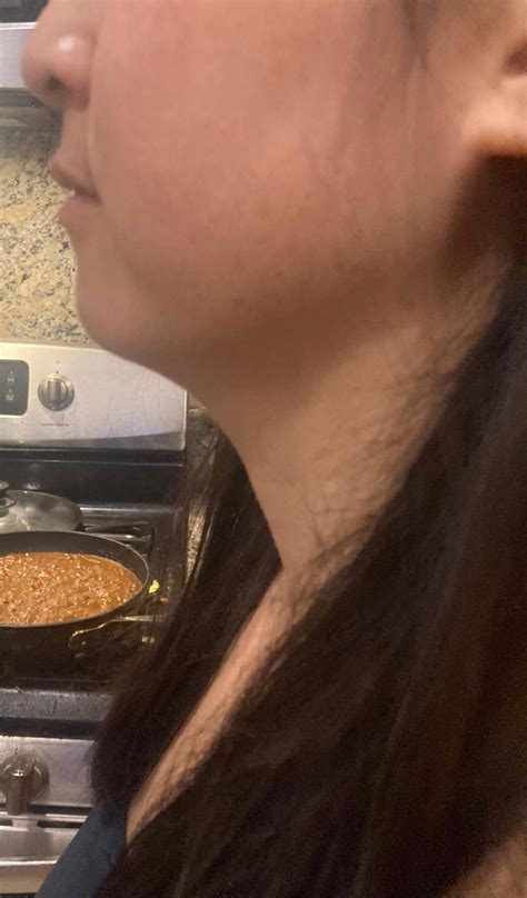 What Is A Good Surgery For A More Defined Jaw R Plasticsurgery