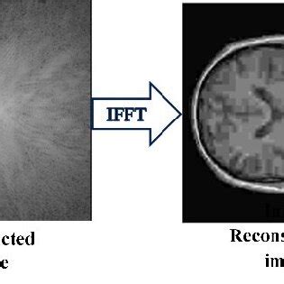 Proposed MRI Reconstruction Method Download Scientific Diagram