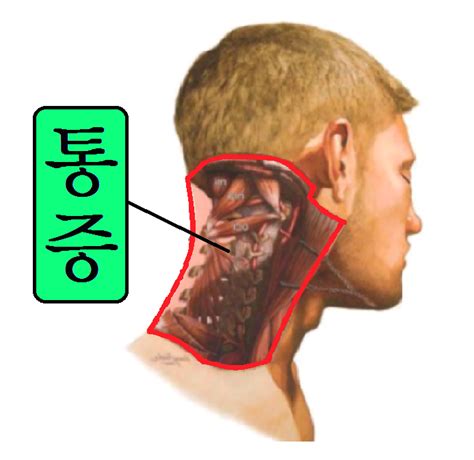 뒷골 두통 뒷목 땡김 해결방법 네이버 블로그