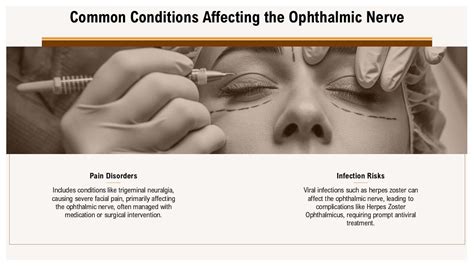 Ophthalmic Branch Of Trigeminal Nerve Foramen Ppt Presentation Acp Ppt