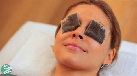 15 روش خانگی از بین بردن سیاهی دور چشم