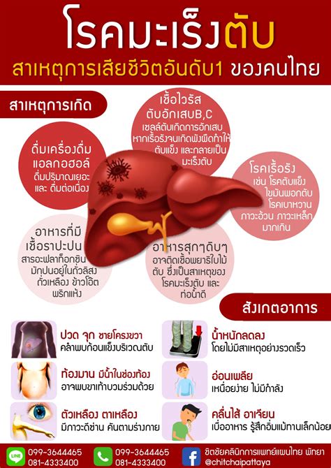 ชิตชัยคลินิกการแพทย์แผนไทย พัทยา 📣 มะเร็งตับ ถือเป็นโรคร้ายแรงอีกหนึ่งโรคที่คร่าชีวิตคนไทย