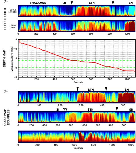 Figure 2 From Functional Localization And Visualization Of The