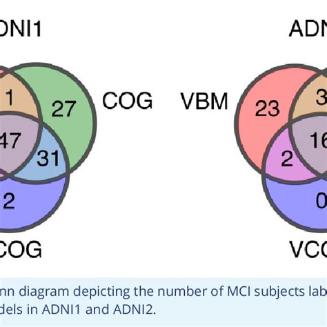 Normal Dat Scan A For Comparison Dat Scan Of A Patient With Dlb Download Scientific