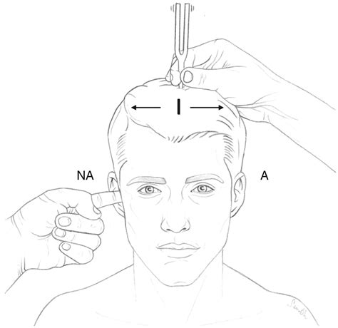 Contralateral Occlusion Test The Effect Of External Ear Canal Occlusion On Predicting