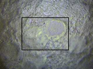 Raman Spectra Of Chondrocytes In Cartilage HySpc Chondro