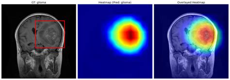Gradcam Enhancing Neural Network Interpretability