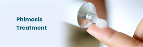 Phimosis Treatment