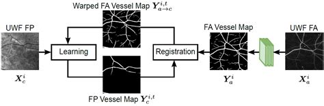 Deep Retinal Vessel Segmentation For Ultra Widefield Fundus Photography Sharma Research Group