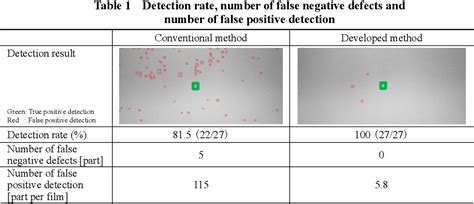 Figure 1 From Development Of High Accuracy Welding Defect Detection Technique For X Ray Images