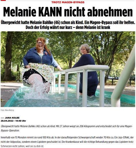 Melanie Leichter Leben Mit Lipödem öffentliche Seite Facebook
